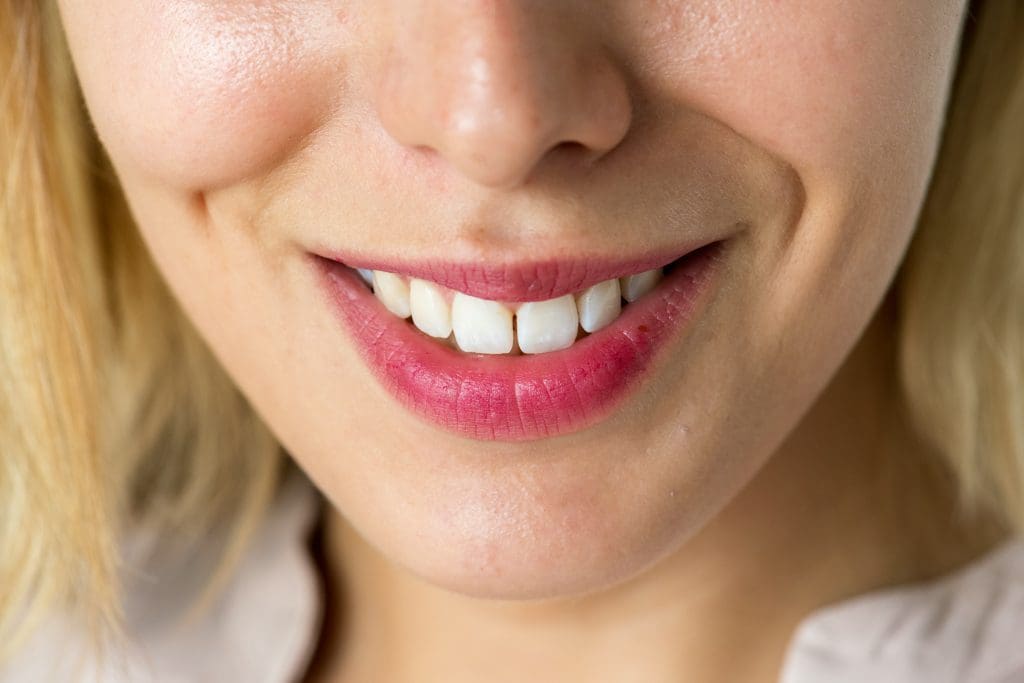 Understanding B1 Tooth Shade and How It Compares to Natural White Teeth ...